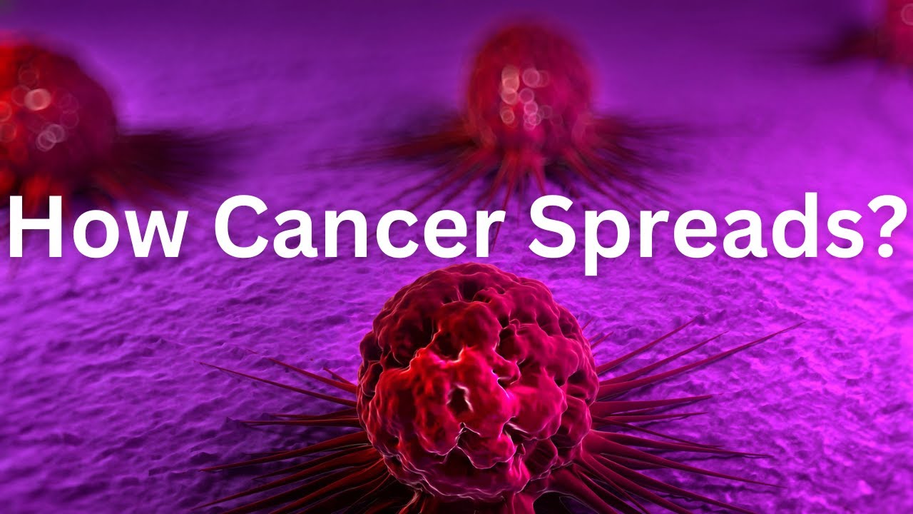 How Does Cancer Spread? - YouTube