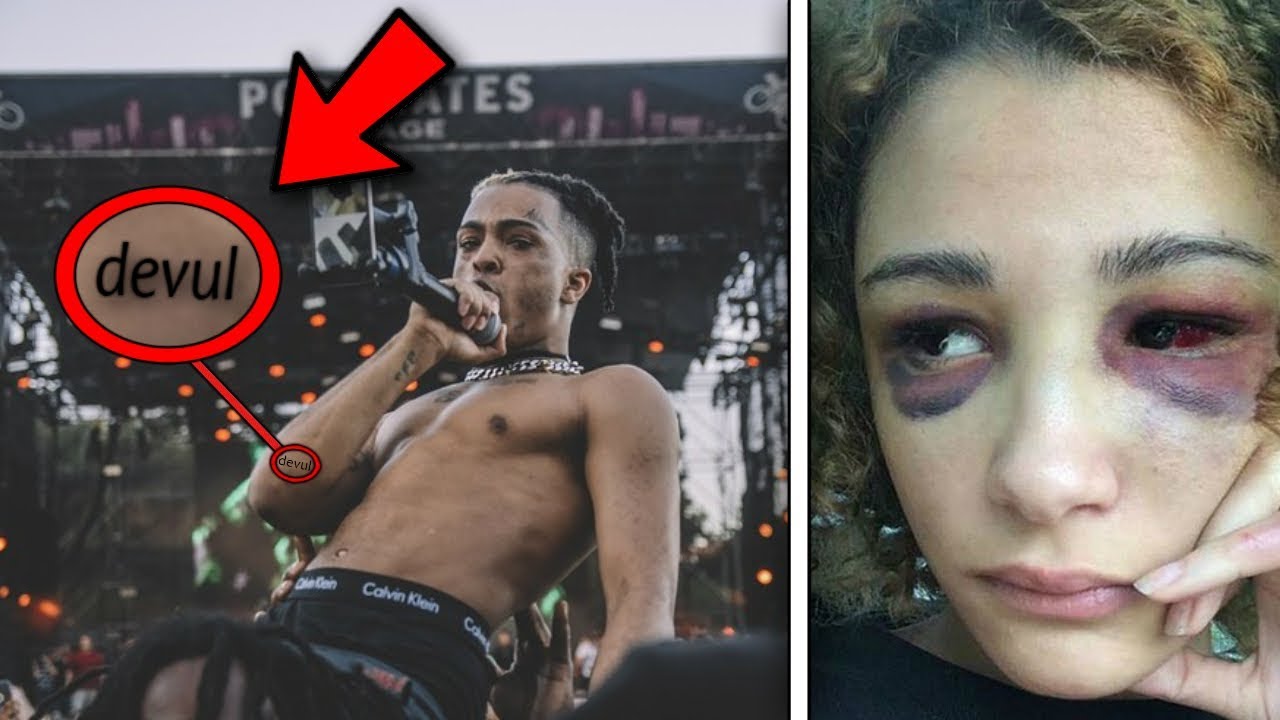Every Xxxtentacion Fan Should Know These 5 Facts Youtube