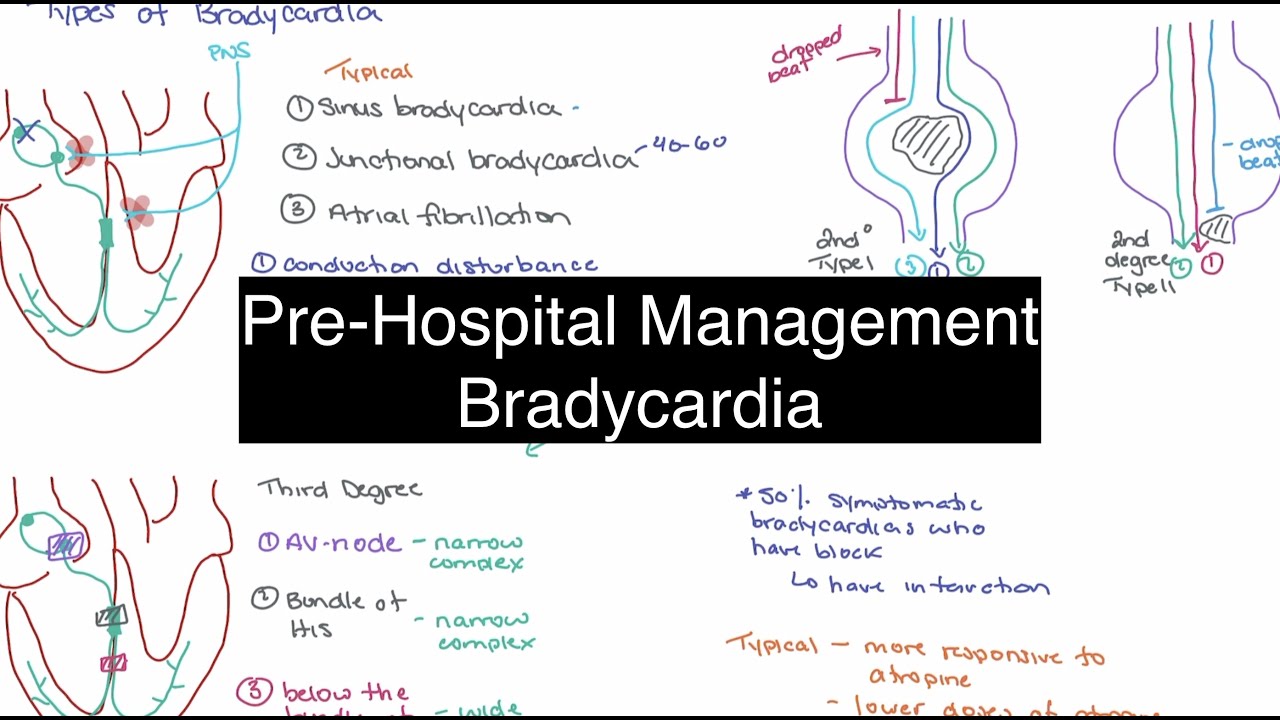 Symptomatic Bradycardia - Prehospital Management - YouTube