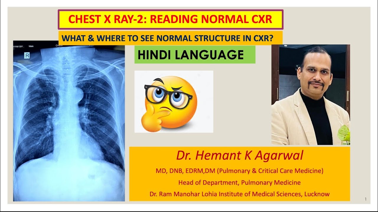 Radiology- Chest X Ray Class-2 (HINDI), How to Read Normal X Ray ...