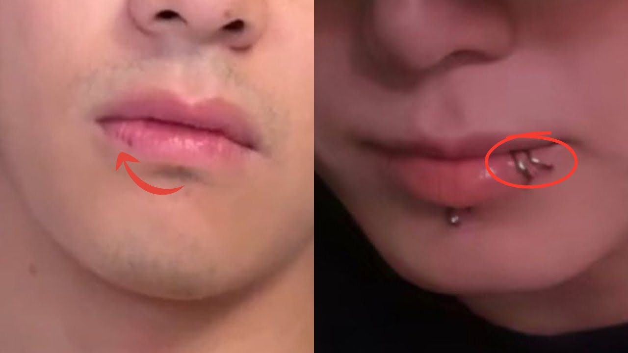¿Taehyung tuvo una herida, en el mismo lado donde Jungkook tiene un ...