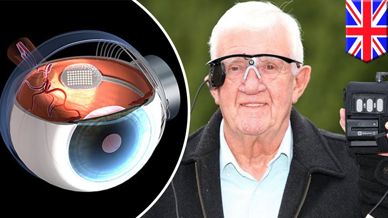Bionic eye: UK blind patients to be fitted with bionic eye to restore ...