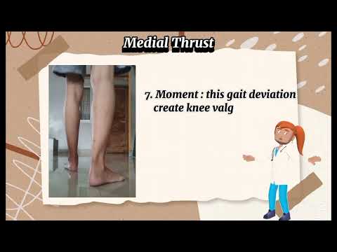 Video Simulation of Common Transtibial Gait Deviations (Group 4) - YouTube