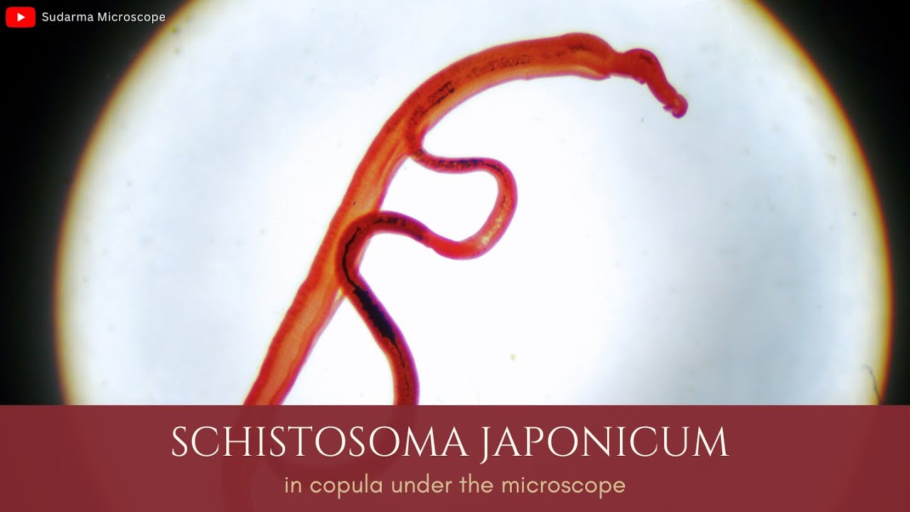 Schistosoma Japonicum In Copula