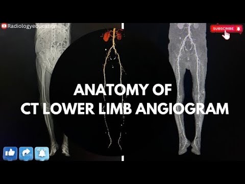 🙂Anatomy Of Ct Lower Limb Angiogram||#radiology#ytvideo#viral#trending# ...