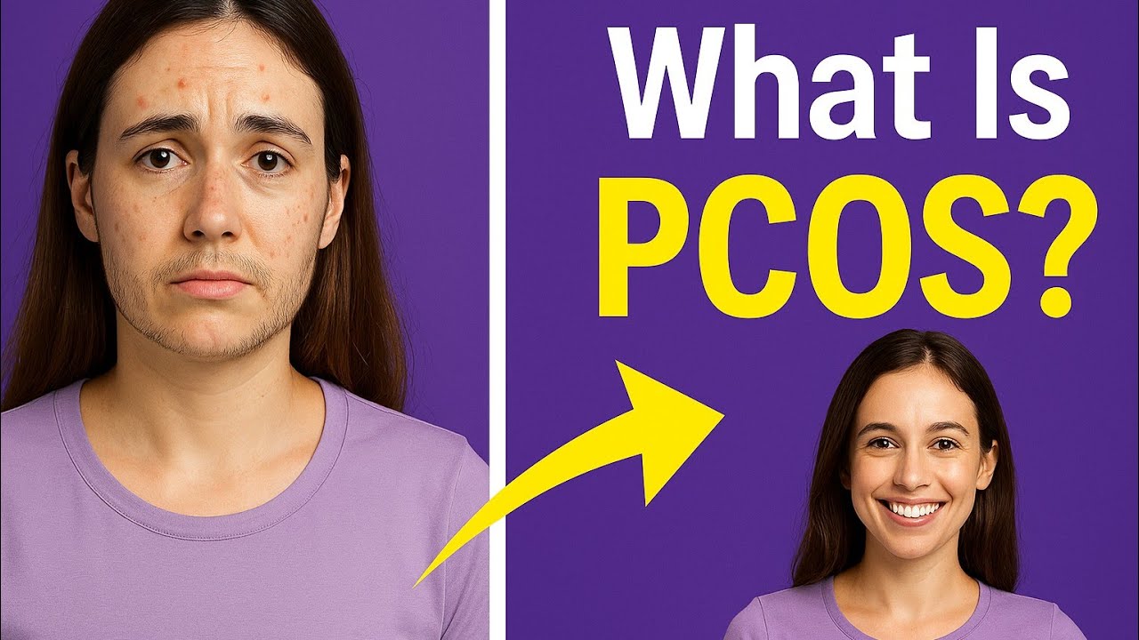 What Is PCOS? | Simple Explanation of Polycystic Ovary Syndrome for ...