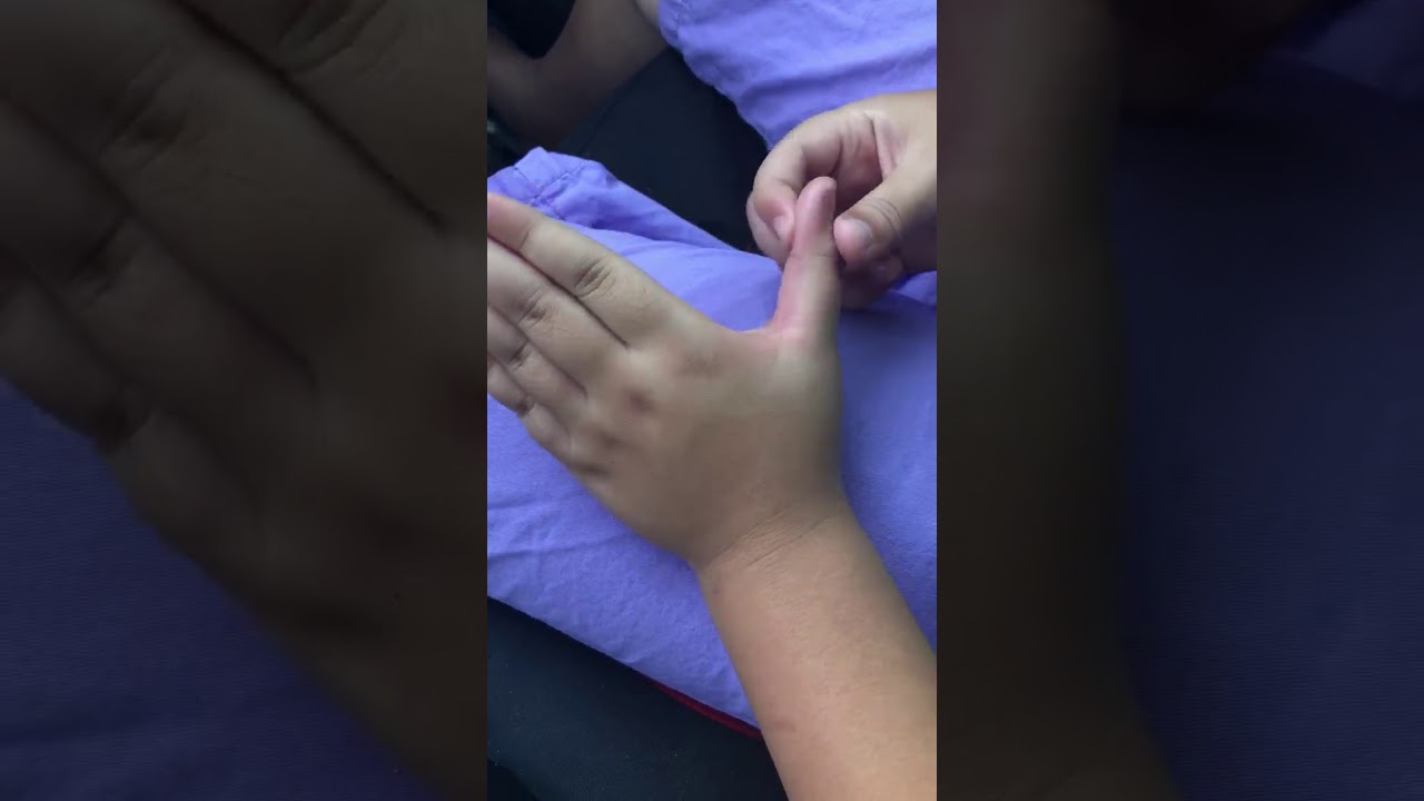 Flexible fingers! How can you do ? - YouTube