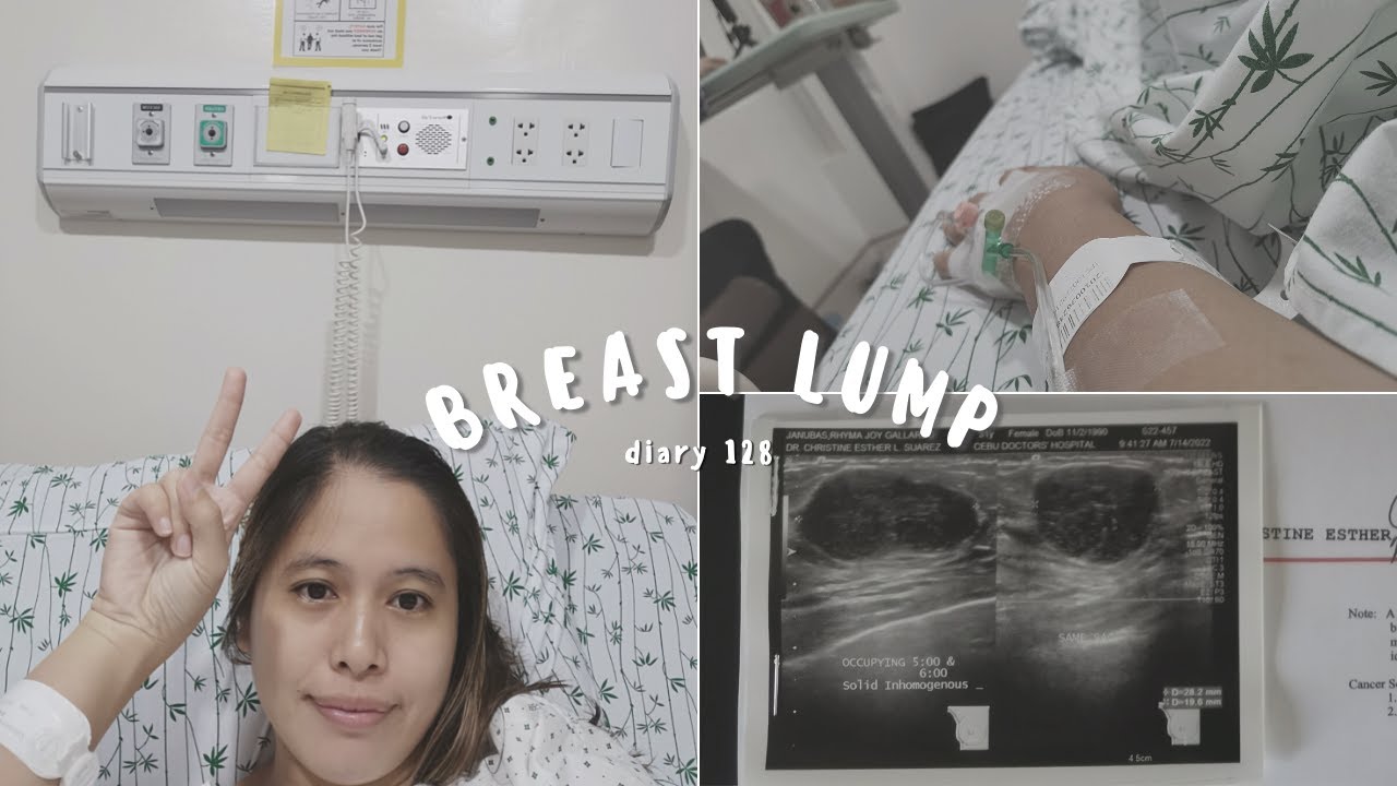 Diary #128: My Breast Lump Journey | Excision Biopsy | Chong Hua ...