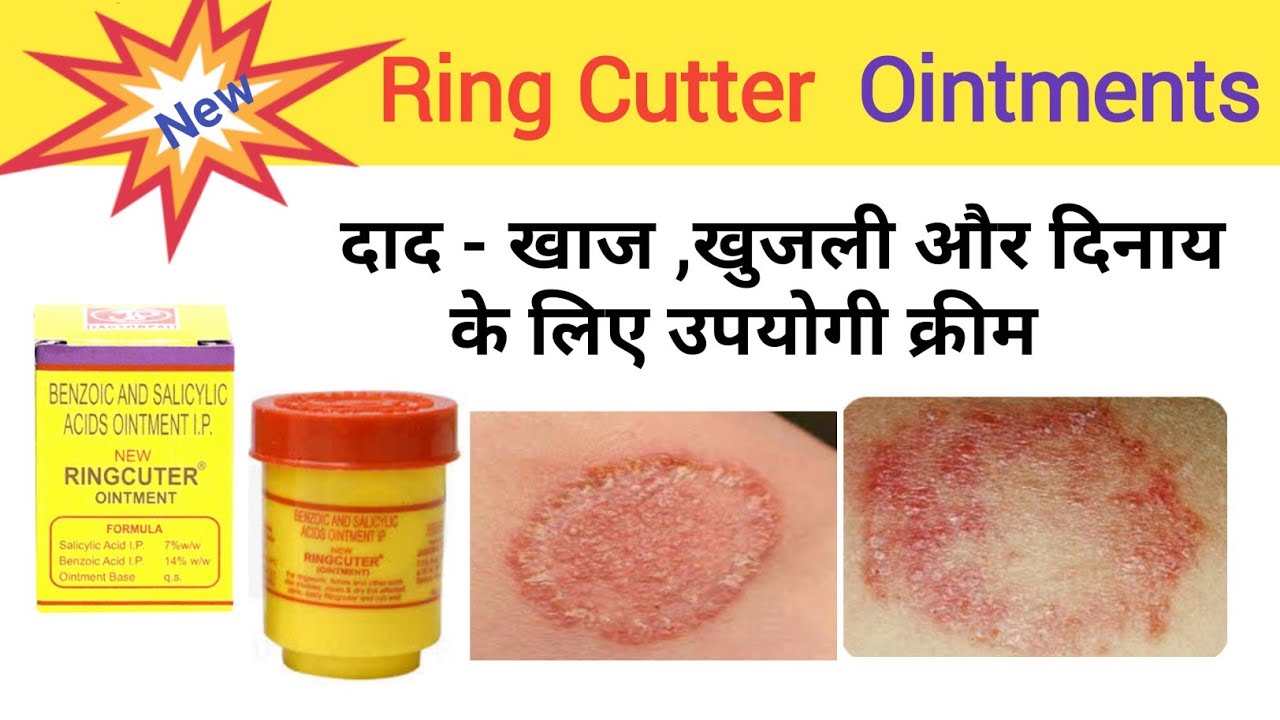 New Ring Cutter Ointments !! दाद -खाज,खुजली और दिनायँ के लिए उपयोगी ...