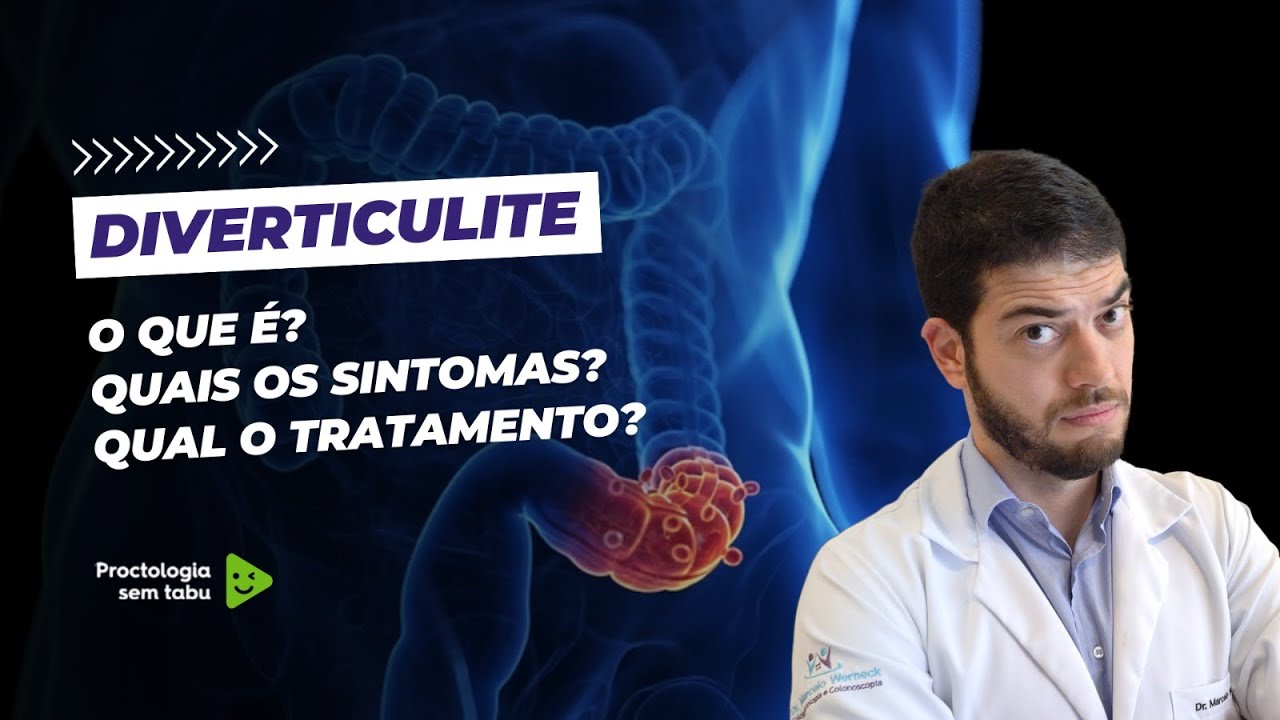 Diverticulite | O que é? Quais os sintomas? Qual é o tratamento? - YouTube