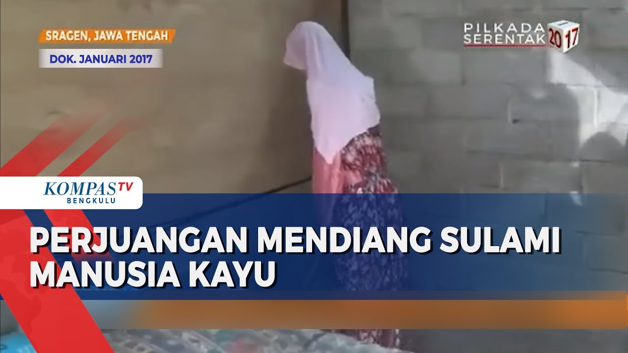 Simak Lagi Perjuangan Mendiang Sulami Manusia Kayu asal Sragen - ARSIP ...
