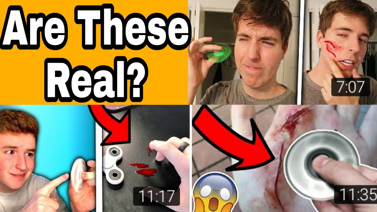 Fidget Spinner Injuries. ARE THEY LEGIT? |Dr Reactions - YouTube