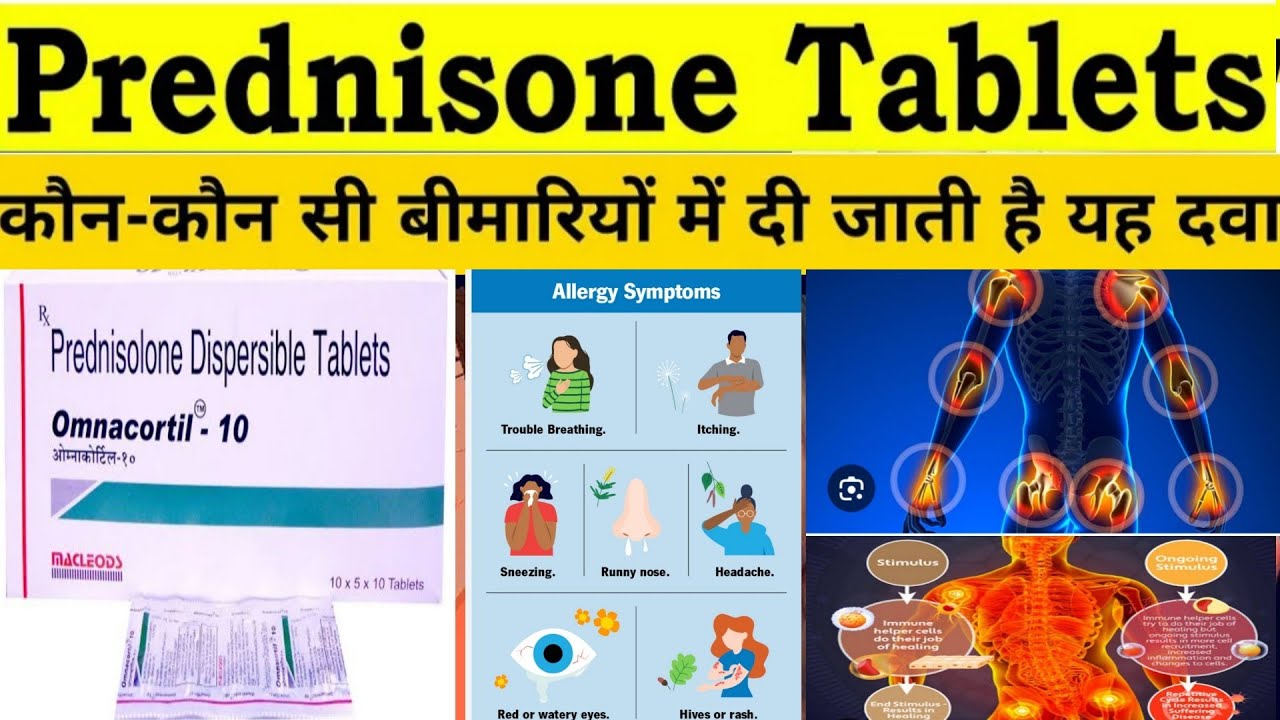 Prednisolone | prednisolone dispersible tablets 10 mg | wysolone tablet ...