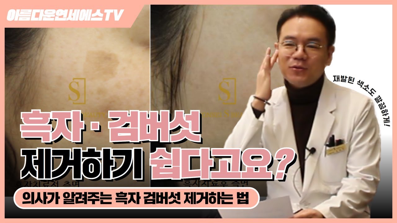 의사가 알려주는 흑자 검버섯 제거하는법 흑자없애는법 검버섯없애는법 검버섯 레이저기미없애는법 【대전세종청주천안공주유성】 피부과 Youtube