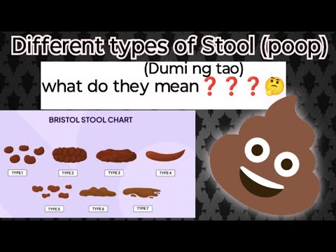 Stools (dumi ng tao) - Different Types of Feces. Why is it important to ...