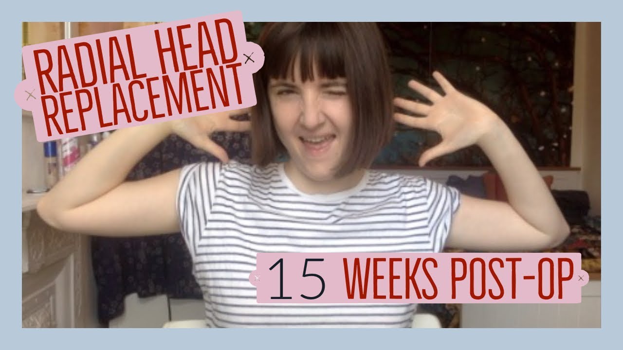Radial head replacement surgery: 15 weeks post-op - YouTube