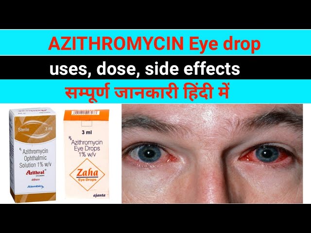 Azithromycin Eye Drops Uses - Infoupdate.org