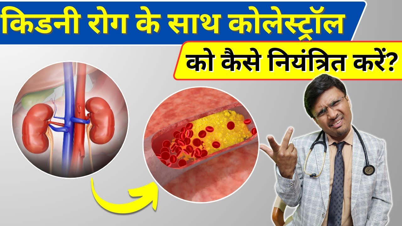How to Manage Cholesterol with Kidney Disease (Expert Tips Inside ...