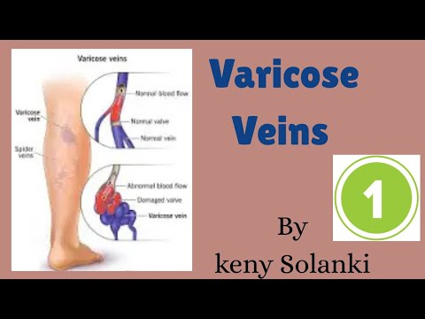 Varicose Veins Part-1 | Pathophysiology #varicoseveinstreatment # ...