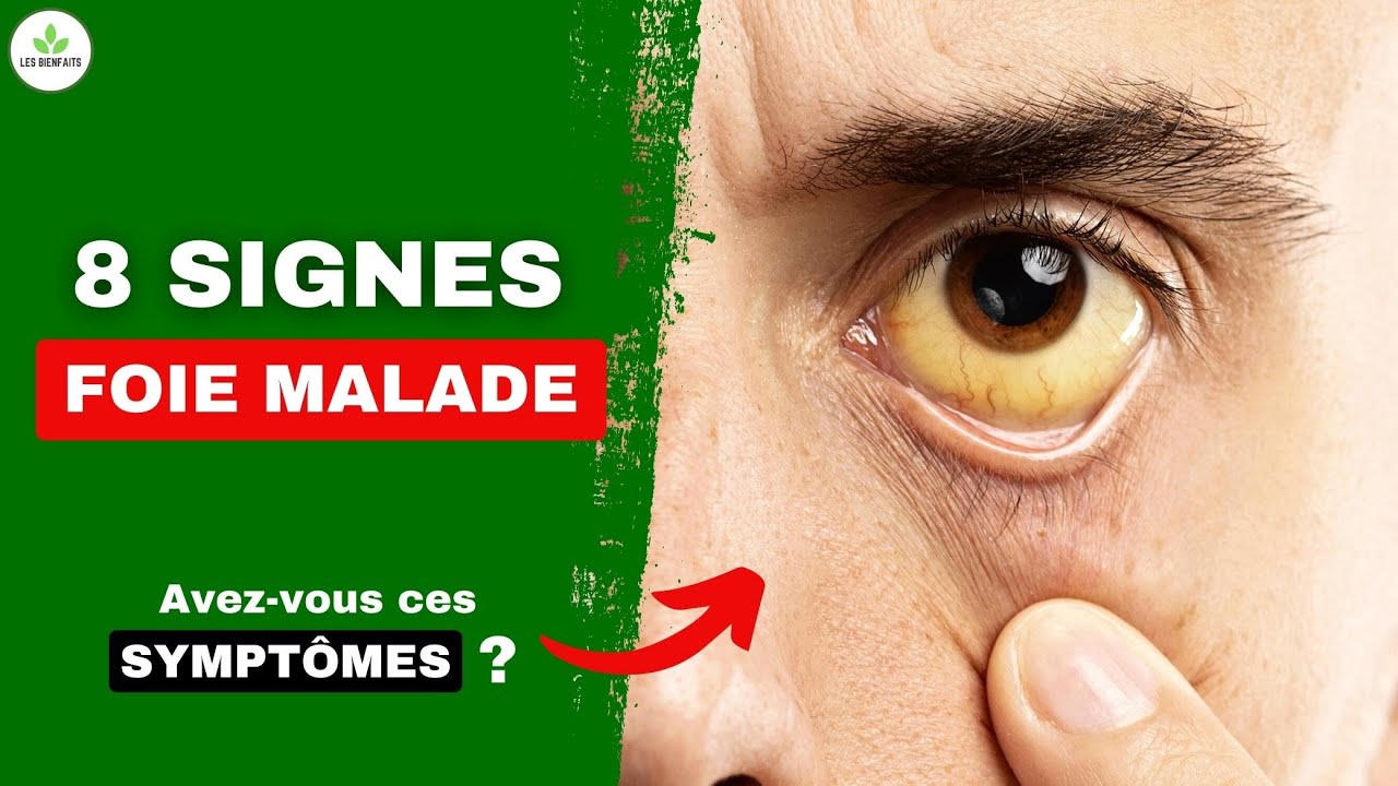 Foie Malade : 8 Symptômes qui devraient vous alerter - YouTube