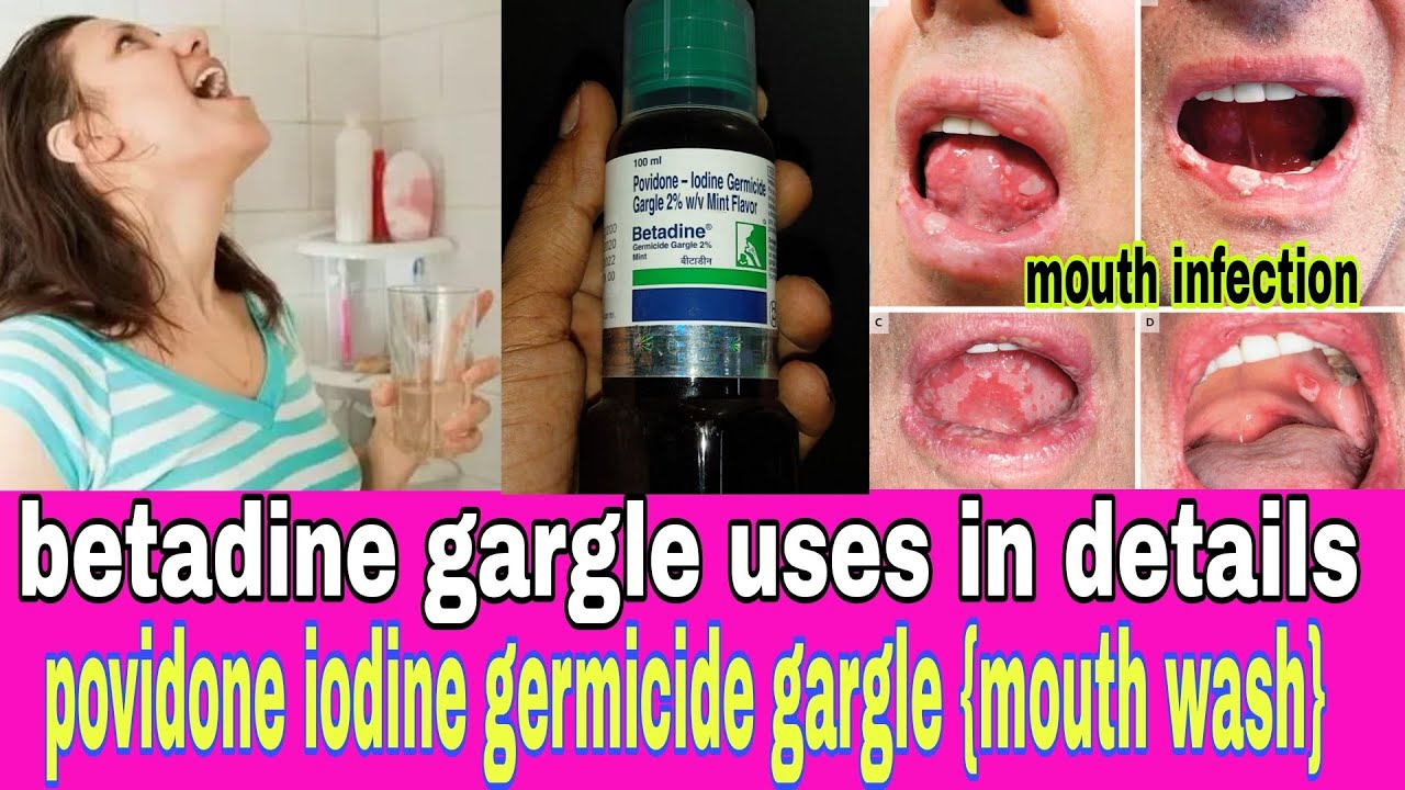 Betadine gargle || povidone iodine germicide gargle 2 w/v mint flavor ...