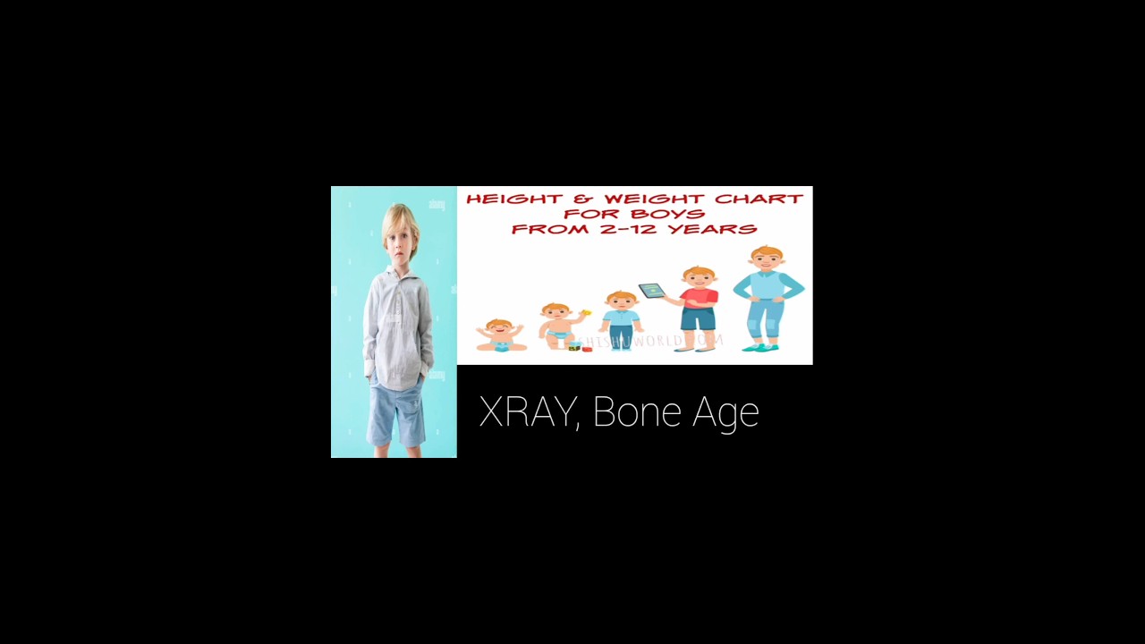 XRAY | Bone Age | Skeletal Survey | Carpel Bone's | Wrist joint | Short stature | Radiologist ...