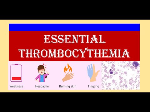 lecture 3-4 Essential Thrombocythemia -ET - YouTube