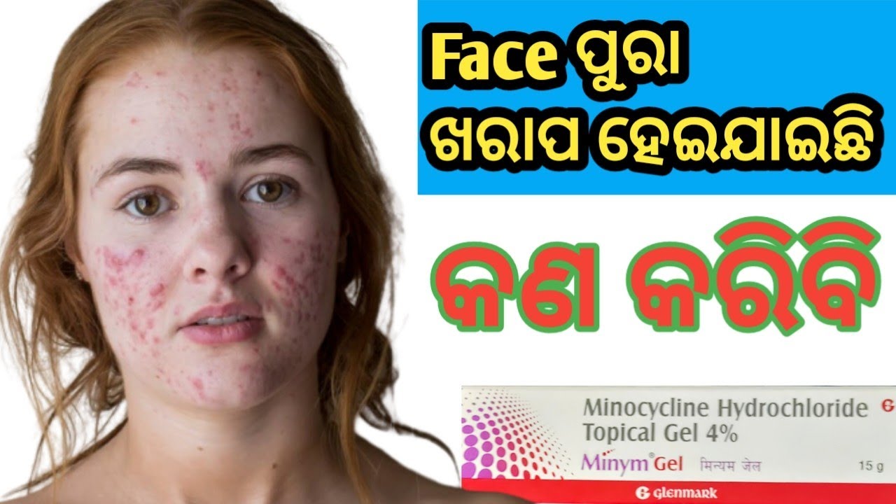 Minym Gel #Minocyclin _Topical_Gel_Uses_Benefits_Side_Effects#Mitu ...