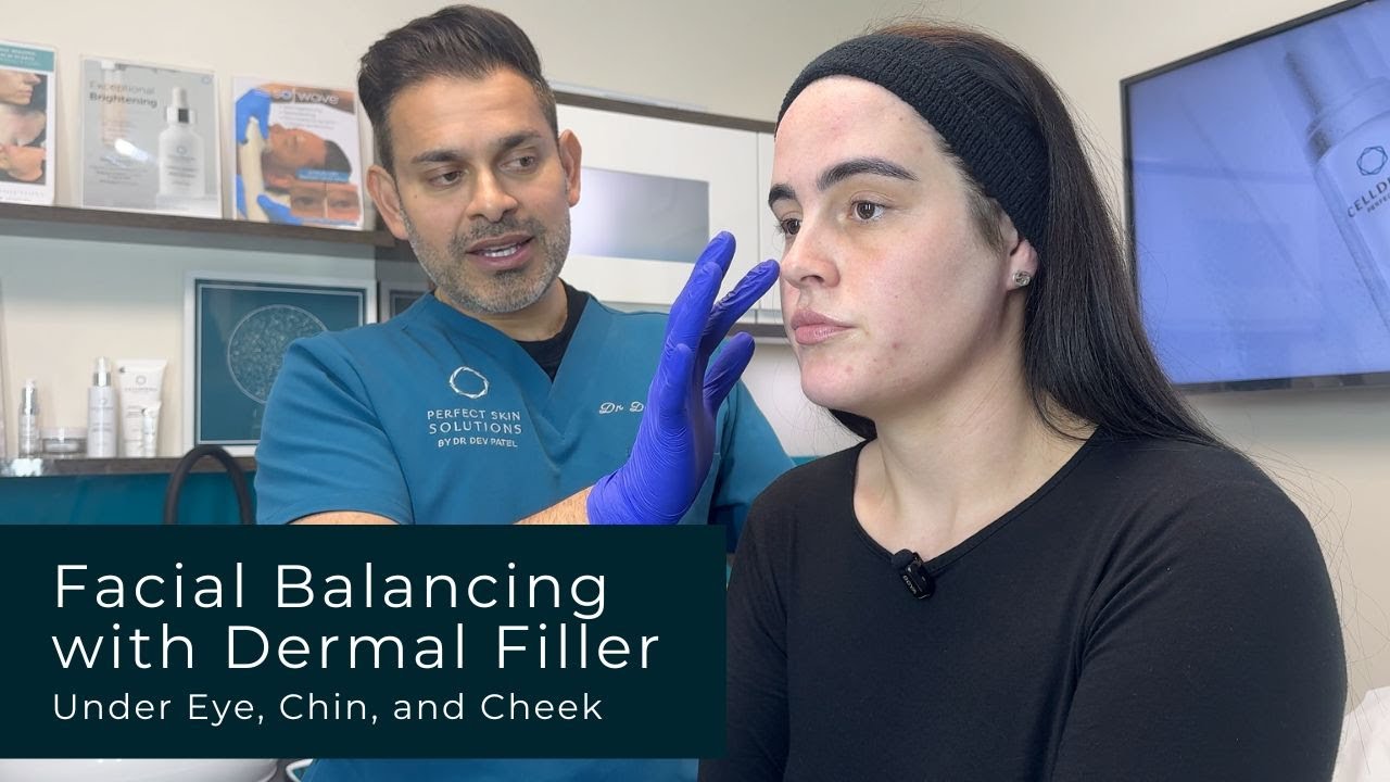 Facial Balancing with Dermal Fillers | Dr Dev Patel - YouTube