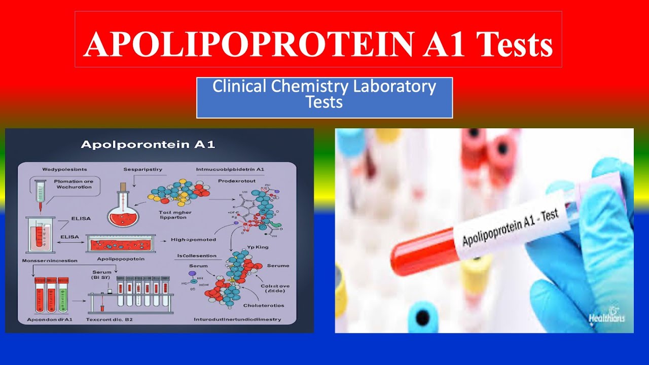 Apolipoprotein A1 Test - Medical Lab Tests - Definition , Uses ...