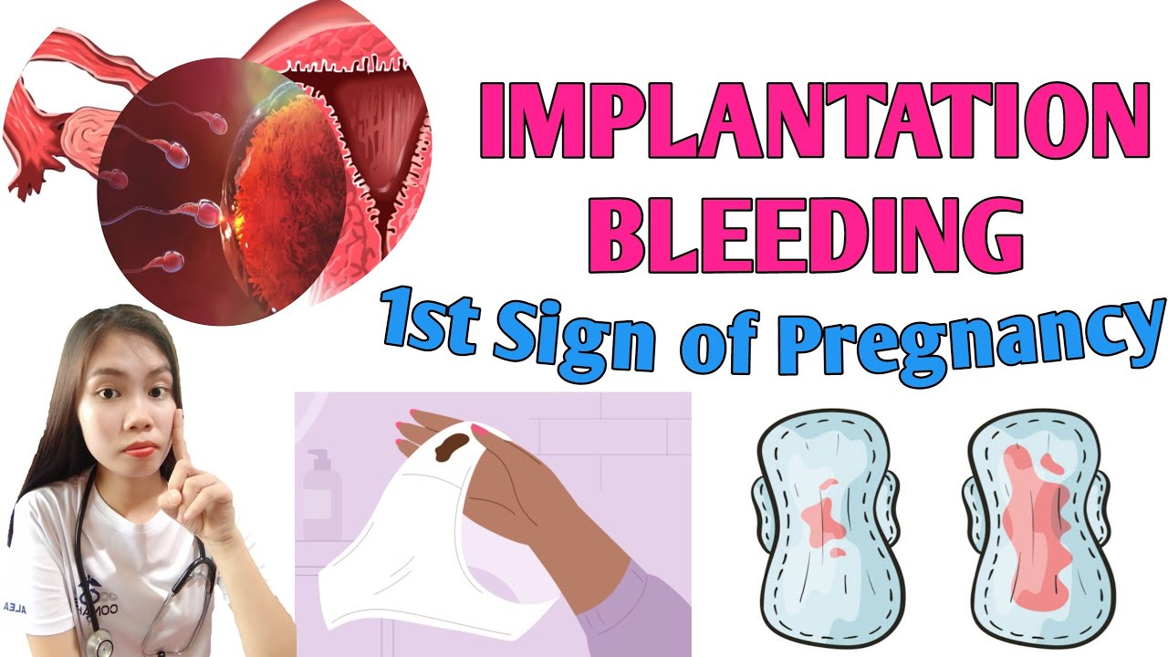 Ano ba ang Implantation bleeding? (Menstruation Vs Implantation ...