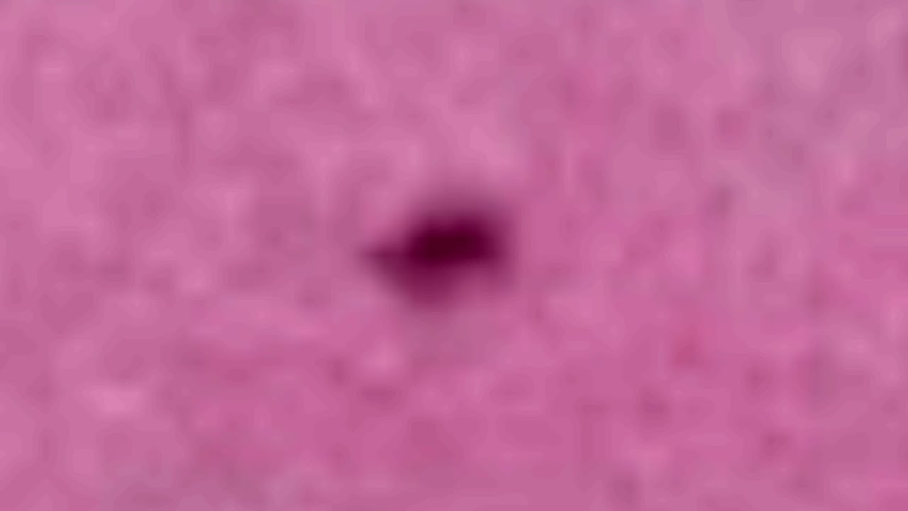 SUNRISE PHOTOGRAPHIC ANOMALY: The Bug, Bird or Bag Dynamic - YouTube