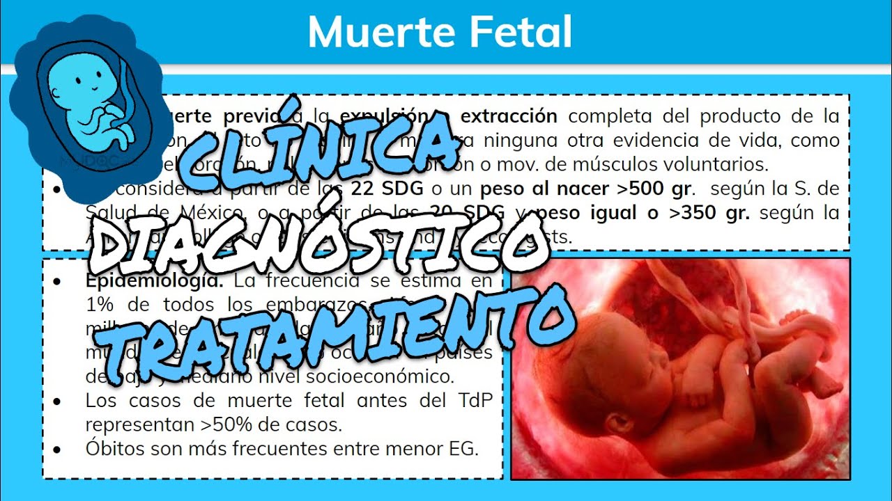 ⚕️🩺 Muerte Fetal (ÓBITO Y MORTINATO) - Ginecología - YouTube
