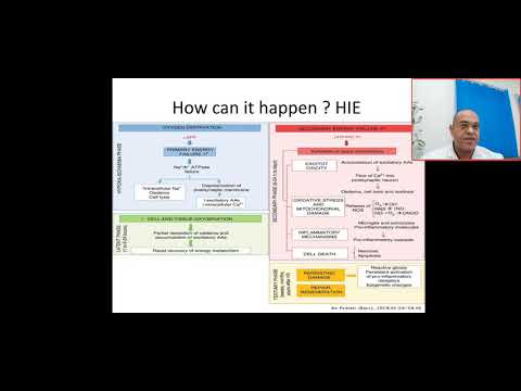 Pathophysiology of HIE, HYpoxic ischaemic encephalopathy, primary ...