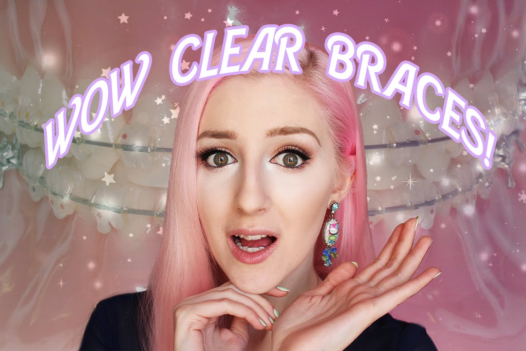 I got Invisalign Braces! - YouTube