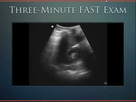 FAST Exam - YouTube