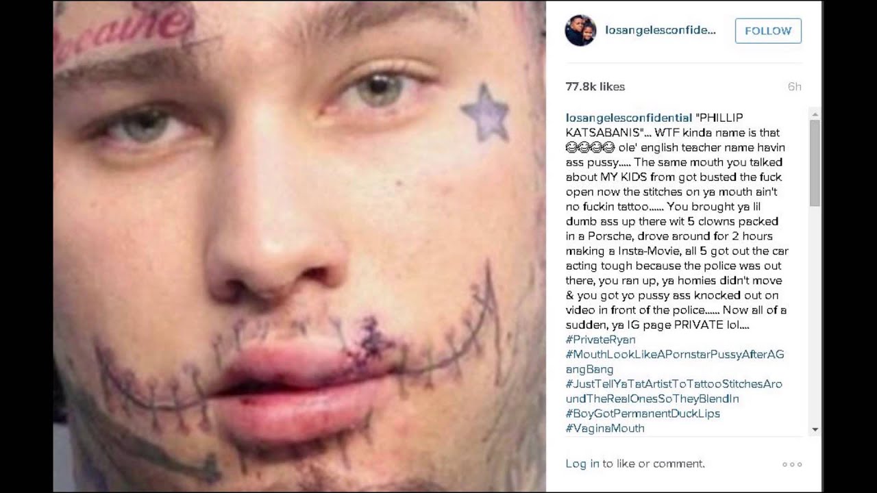 White Rapper Stitches outta jail after getting KO'd in Miami ...