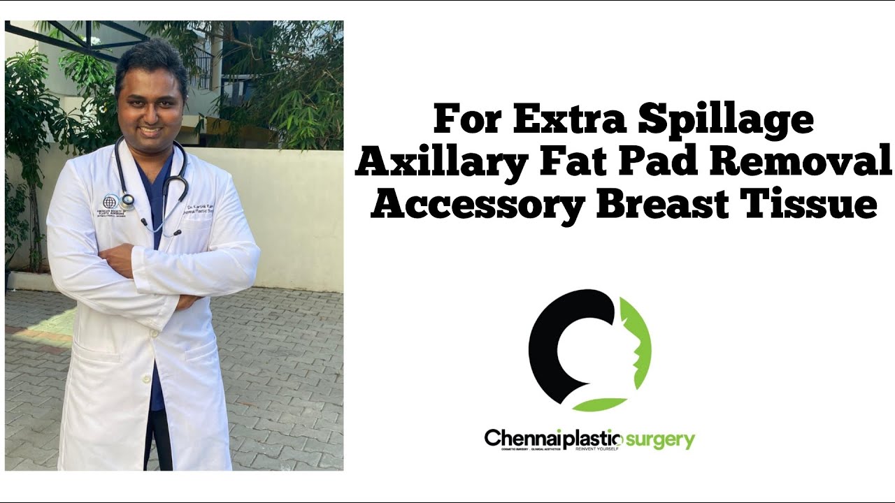 Axillary Fat Pad Removal | Accessory Breast Tissue - Dr.Karthik.R - YouTube