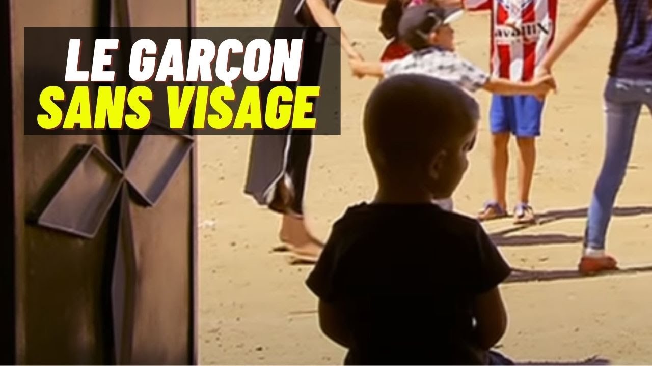LE GARÇON SANS VISAGE : L'INCROYABLE HISTOIRE DE YAHYA - YouTube
