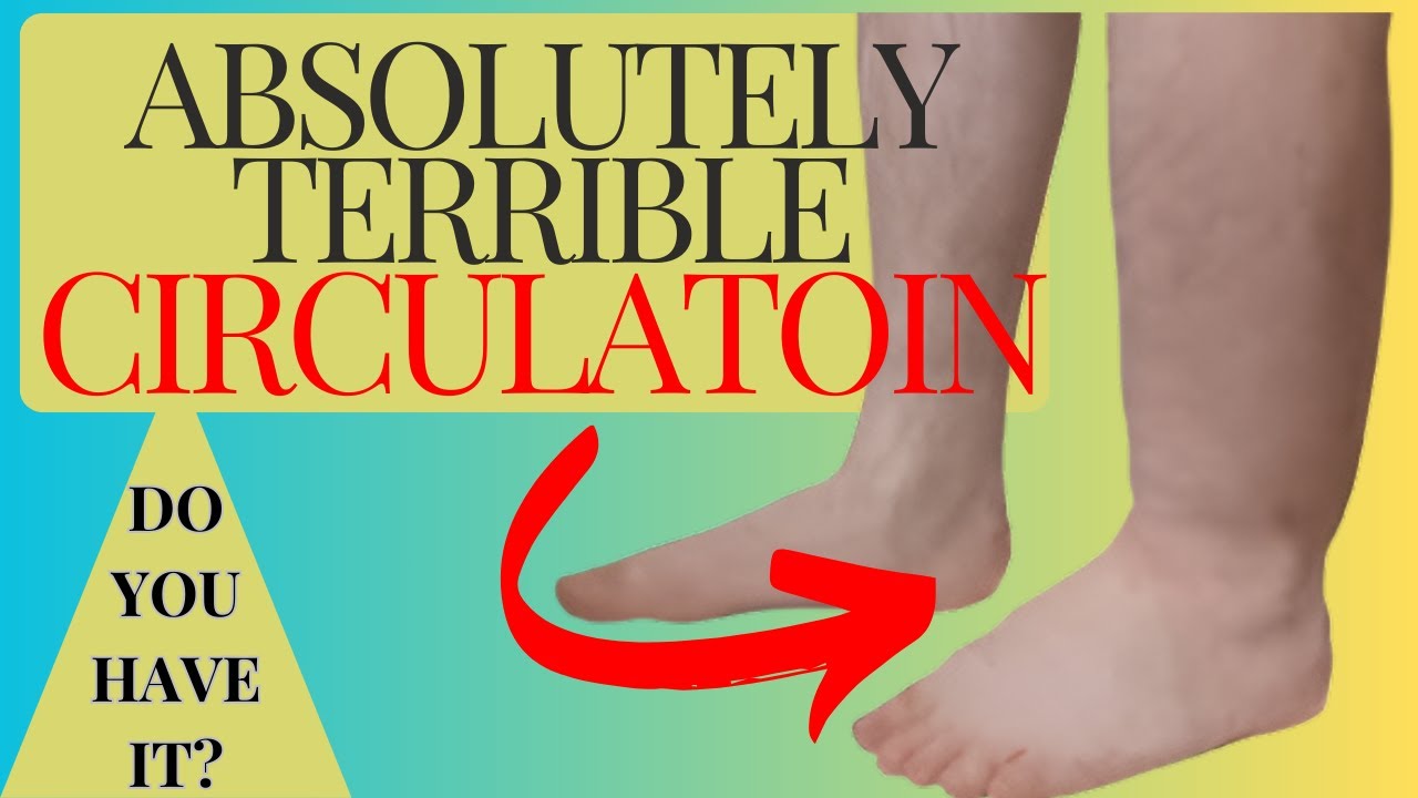 Circulation Secrets: How to Improve Blood Flow Naturally - YouTube