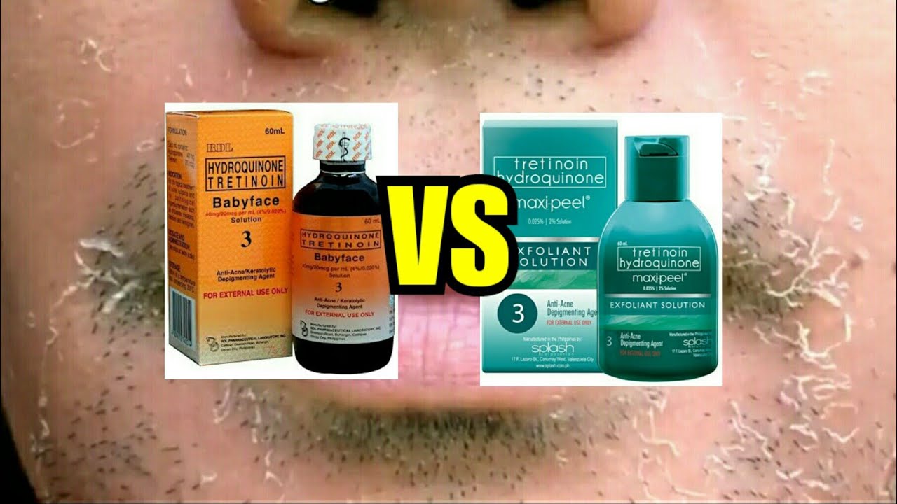 RDL vs Maxipeel Review I Used Both On My Face - YouTube
