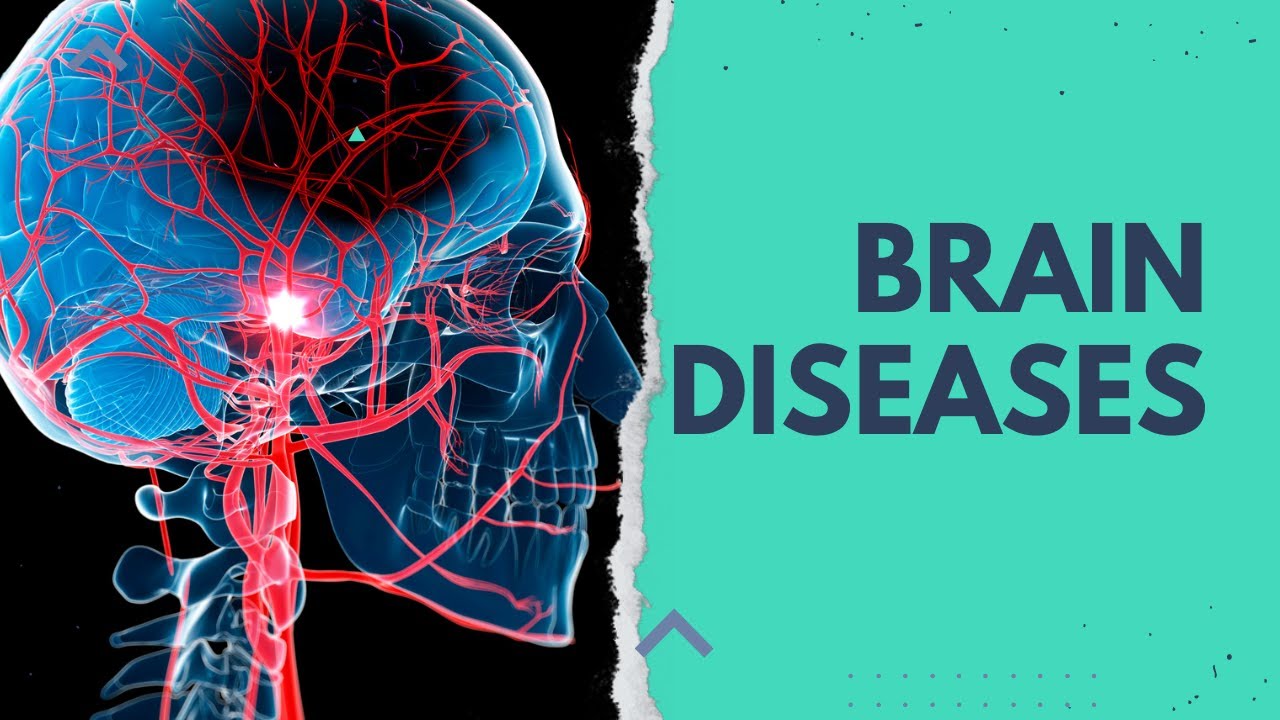 Brain Diseases - YouTube
