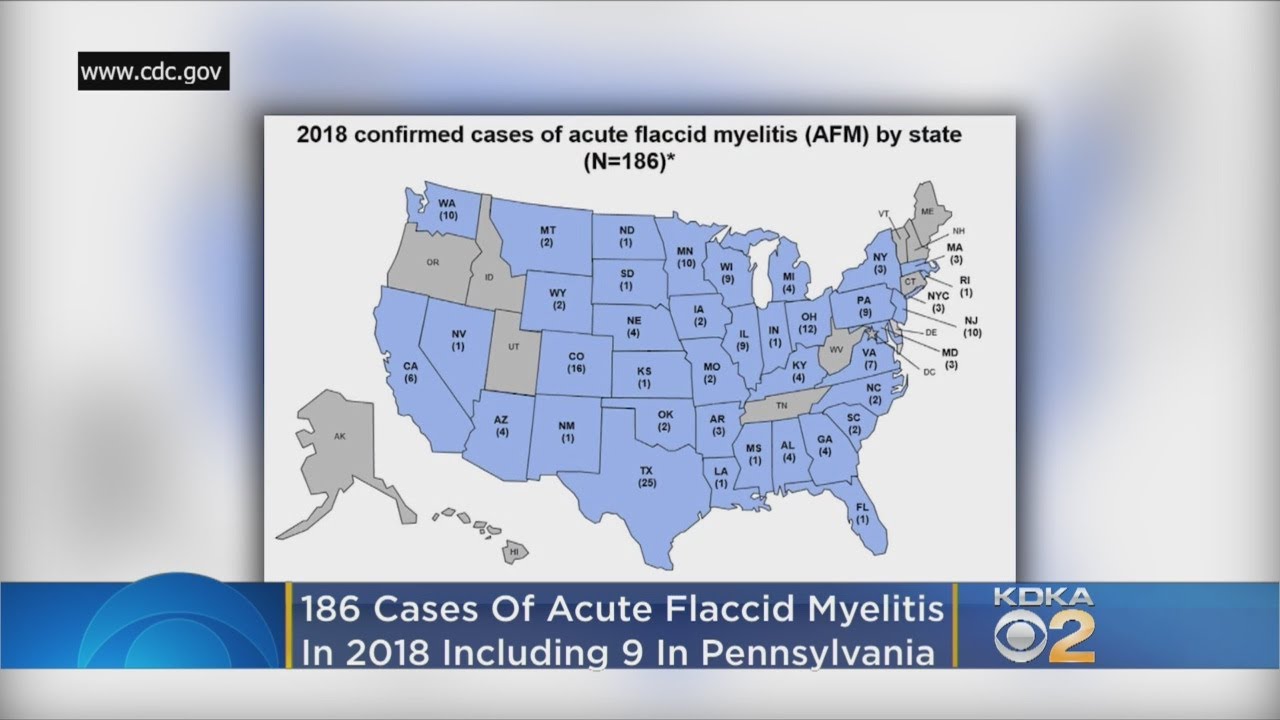 CDC: Nearly 200 Cases Of AFM Confirmed In U.S. In 2018 - YouTube