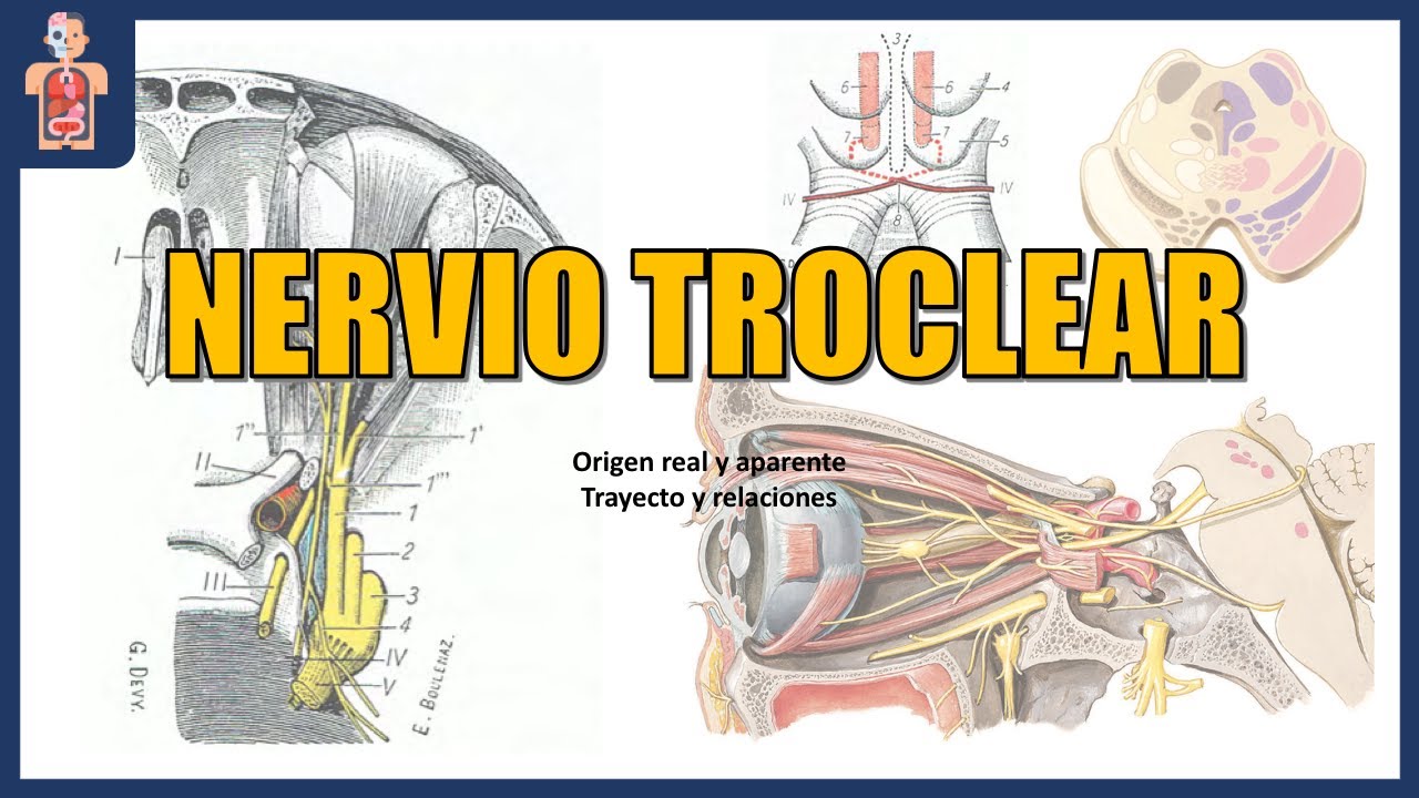 NEUROANATOMÍA - NERVIO TROCLEAR (ORIGEN, TRAYECTO, RELACIONES Y ...