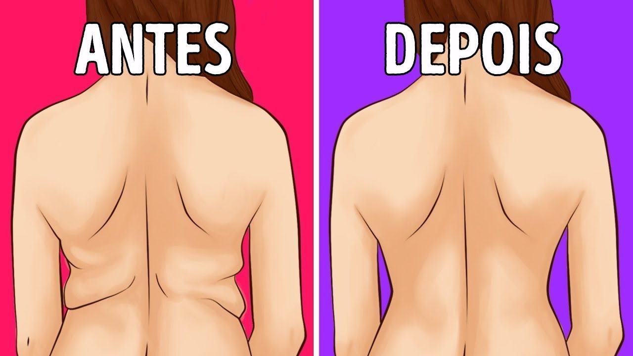 Como Qualquer Um Pode Conseguir Reduzir Os Pneuzinhos Laterais
