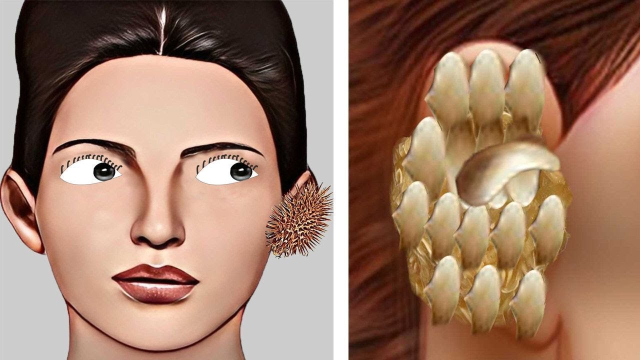 ASMR ANIMATION TREATMENT - YouTube