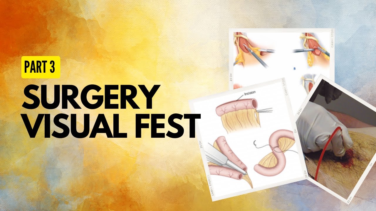 Surgery Dada Visual Fest Round 2: High-Yield Images for NEET PG, INI ...
