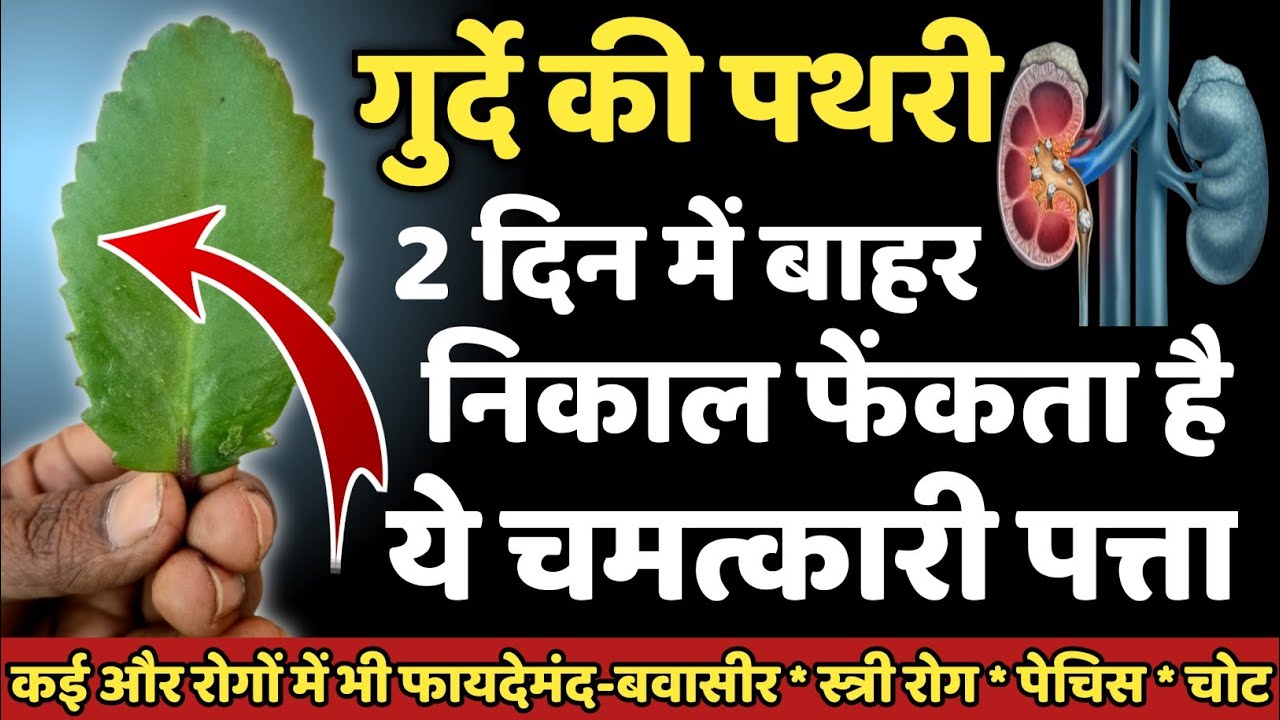 पथरी को गलाकर बाहर निकालें 2 दिन में😲||Pathri ka desi ilaj kya hai ...