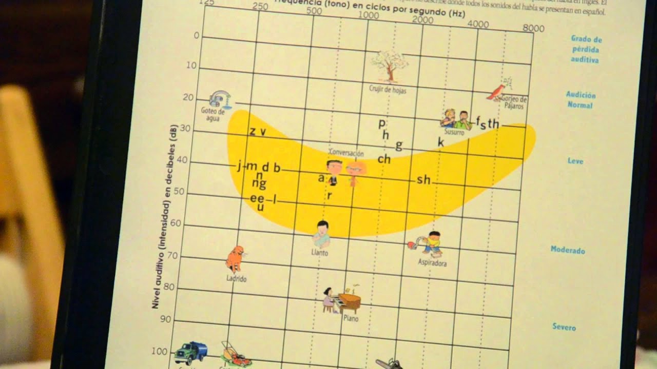 ¿Cómo entender una audiometría? - YouTube