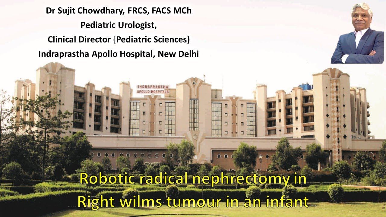 Robotic Radical Nephrectomy in Right wilms tumour by Dr Sujit Chowdhary ...